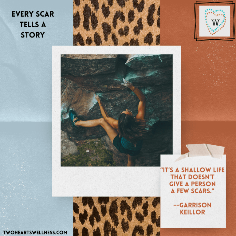 Every Scar Tells a Story (Physical Scars and What to Consider About ...